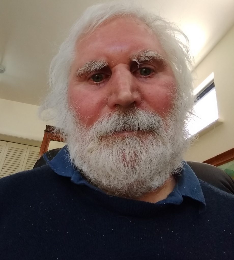 Jim's story - PSPA